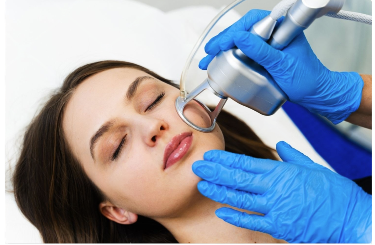 Unlock Radiant Skin: Top Laser Treatments for Wrinkles, Acne Scars ...